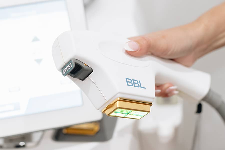 What Is BBL Photofacial? Facts To Know Before Your Appointment